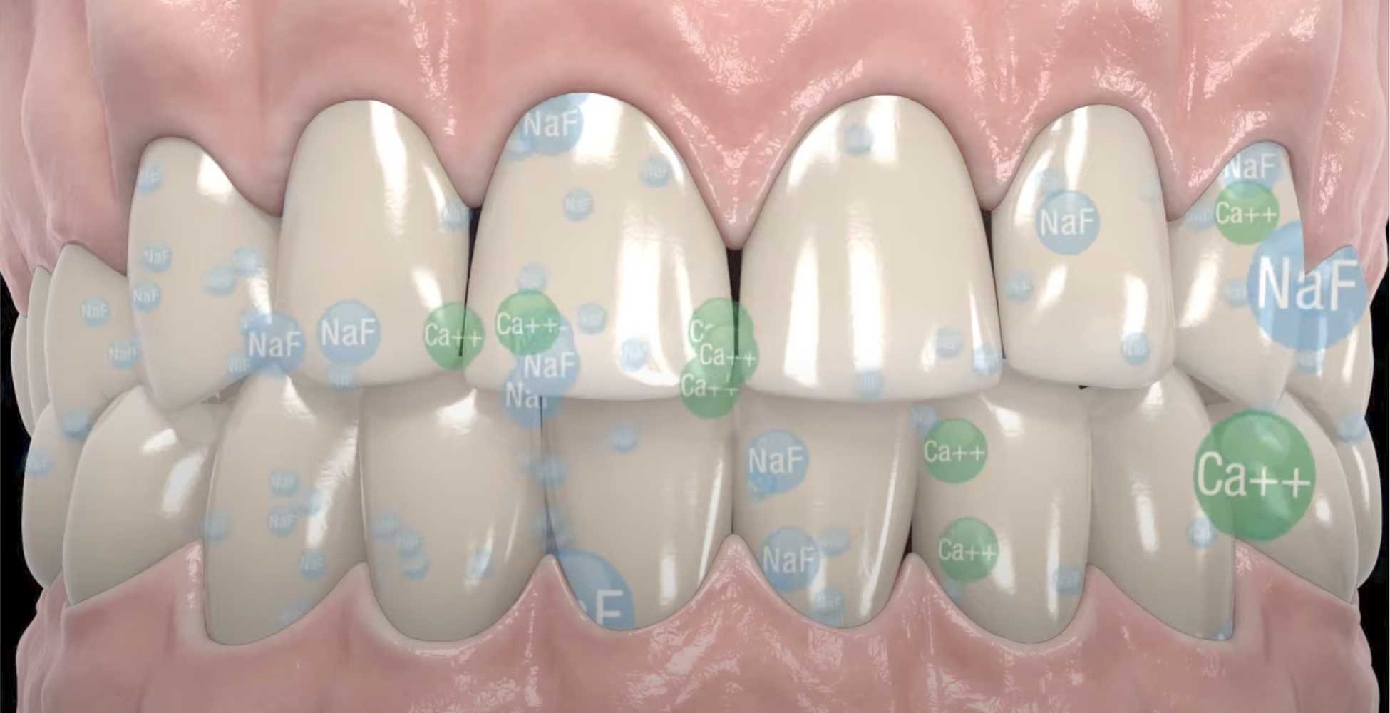 Crema Dental Opalescence Whitening Toothpaste - Ultradent - Casa Dental ...